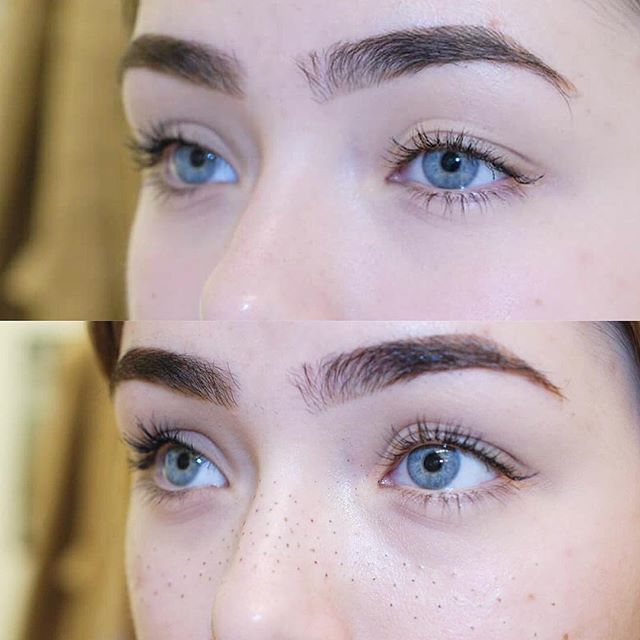 Permanent Freckle Tattoo – All Things Tattoo